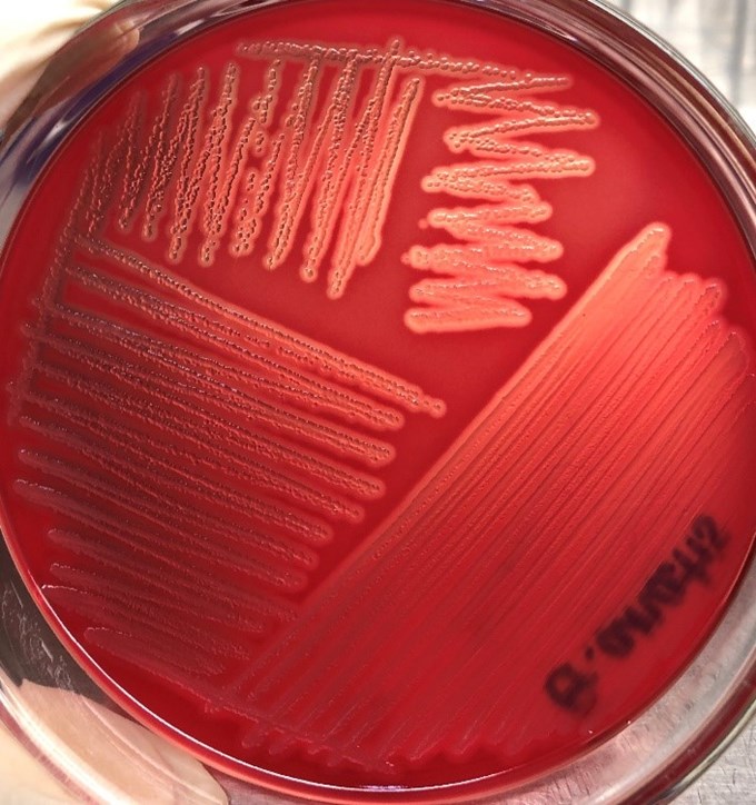 Gallibacterium anatis – Mần bệnh mới nổi trên gia cầm tại Việt Nam ...